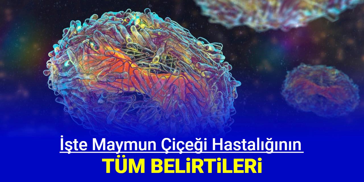 İşte maymun çiçeği hastalığının belirtileri - Finans 7