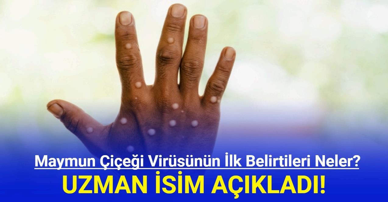 Maymun çiçeği hastalığının ilk belirtilerini uzman isim açıkladı ...